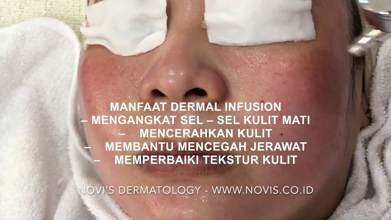 NOVI'S Dermatology Clinic - Derma Infusion by dr. Novi Arlisma - YouTube