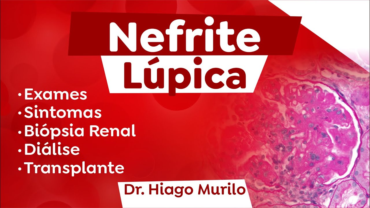 Quais são os Sintomas da NEFRITE LÚPICA? - YouTube