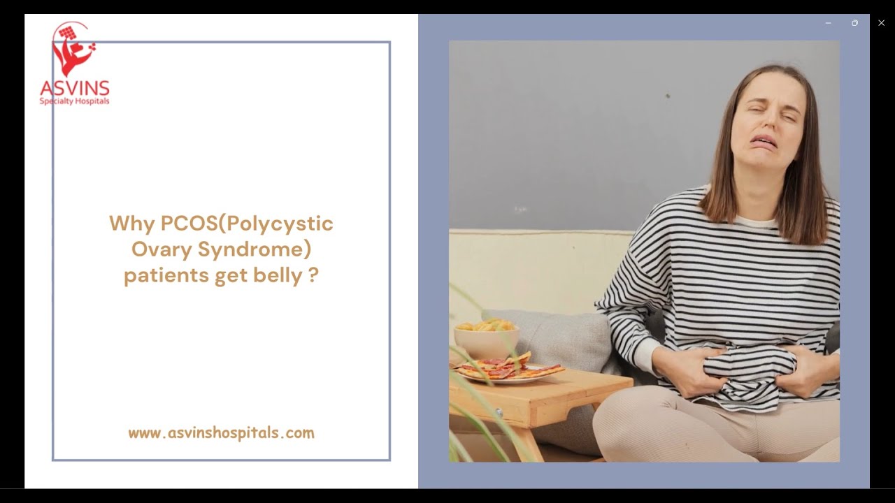 Why PCOS (Polycystic Ovary Syndrome) patients get belly - YouTube