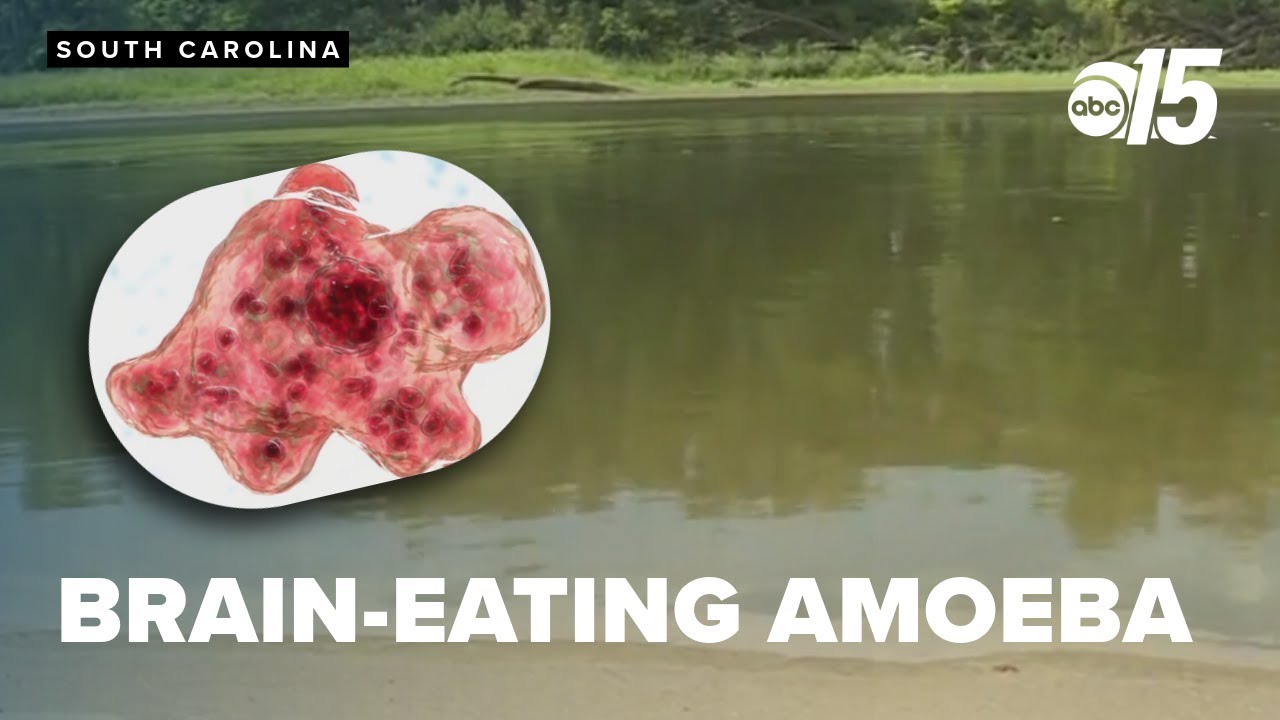 Patient dies from brain-eating amoeba after swimming in SC waters - YouTube