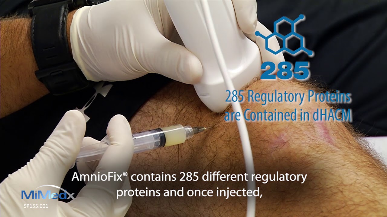 SP155 001 AmnioFix Waiting Room Office Video - YouTube