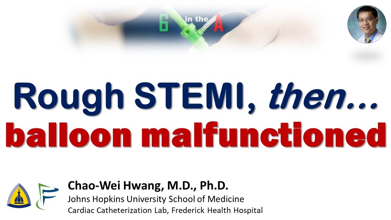 Rough STEMI then balloon could not deflate! - YouTube