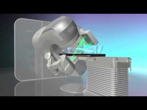 Cone beam CT CBCT VSS HIGH 1280x720 ipad