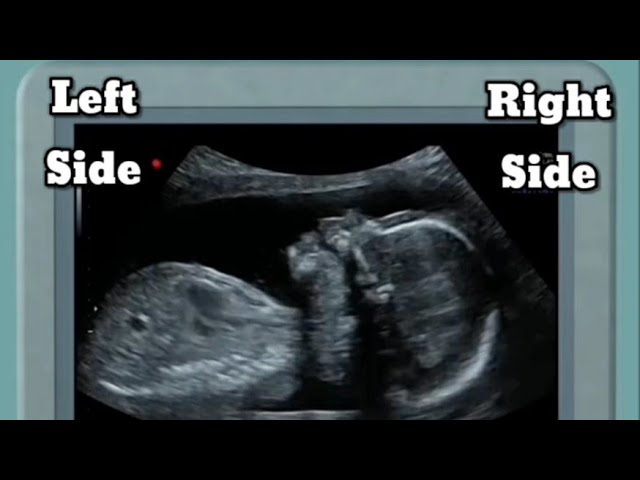 Fetal Presentations Ultrasound Images, 53% OFF