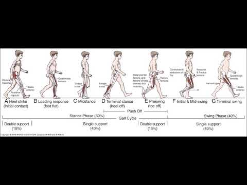 Calcaneal Gait Pattern - YouTube