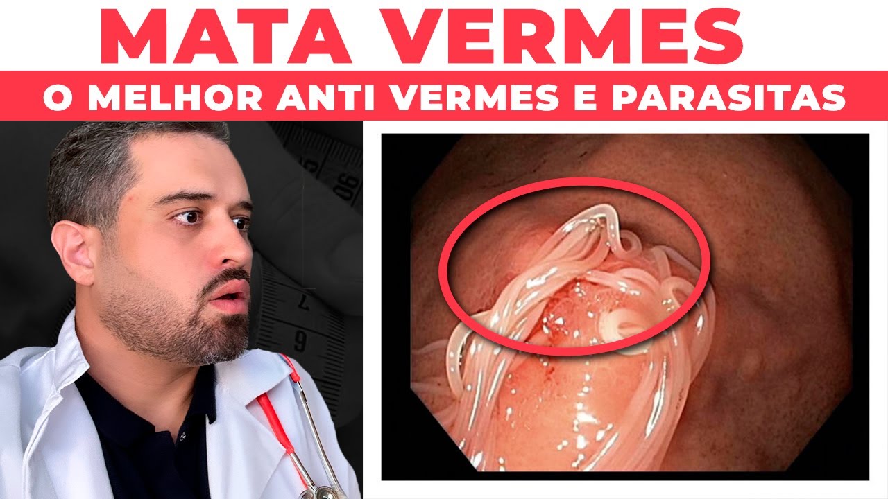 O MELHOR REMÉDIO do MUNDO pra MATAR VERMES e PARASITAS em 7 DIAS? - YouTube
