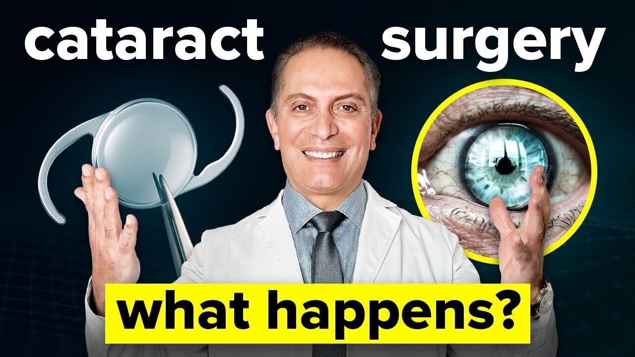 CATARACT SURGERY: What to Expect Before, During & After? - YouTube