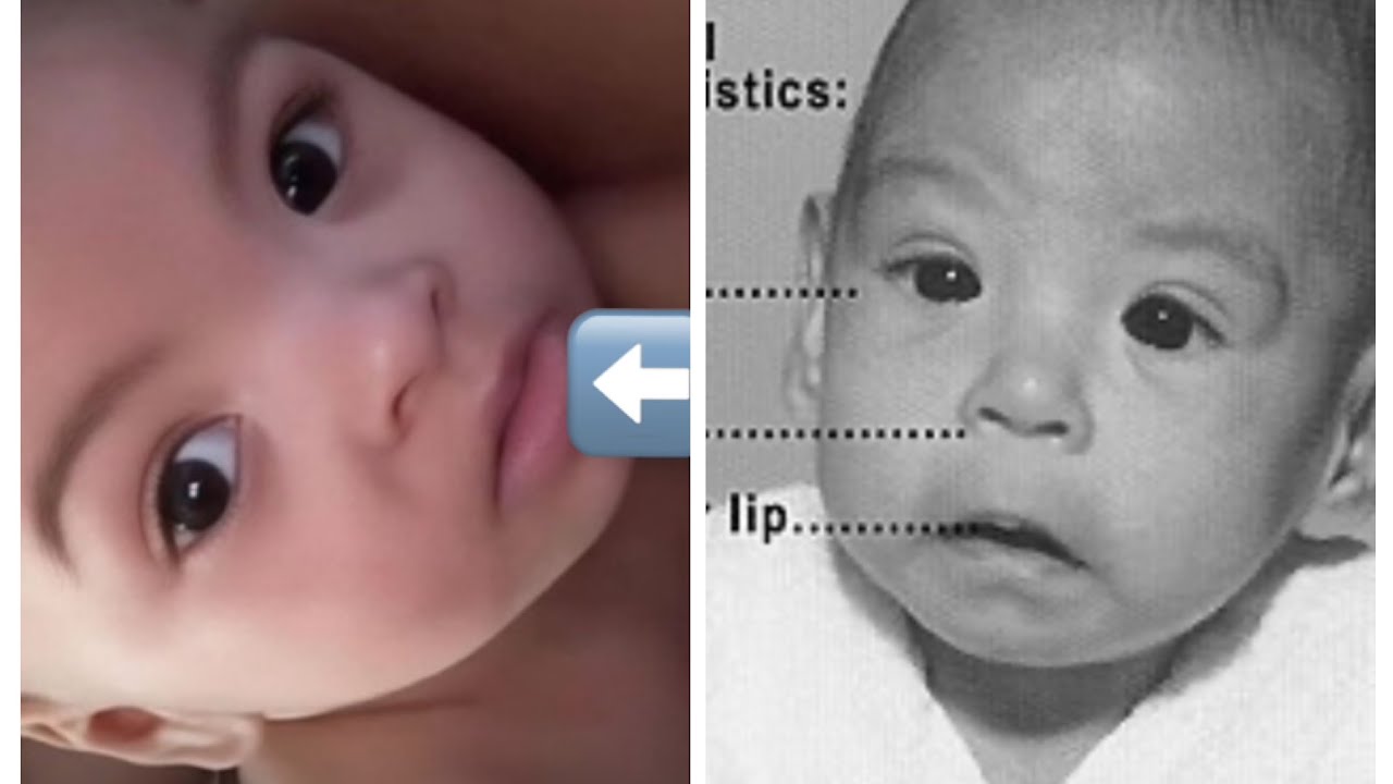 If you think Chrisean jr has fetal alcohol syndrome disorder please ...