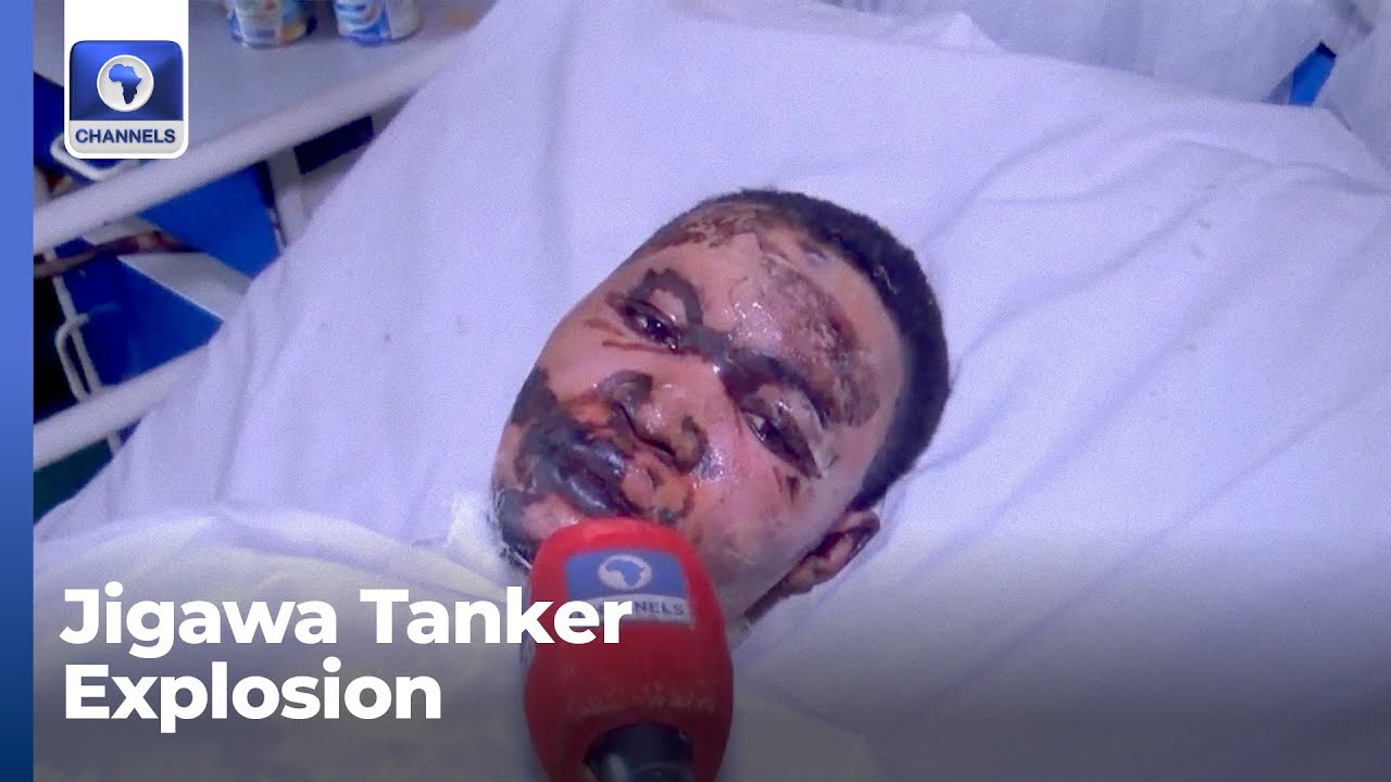 Jigawa Tanker Explosion: Fatality Figure Rises To 170, 73 Still ...