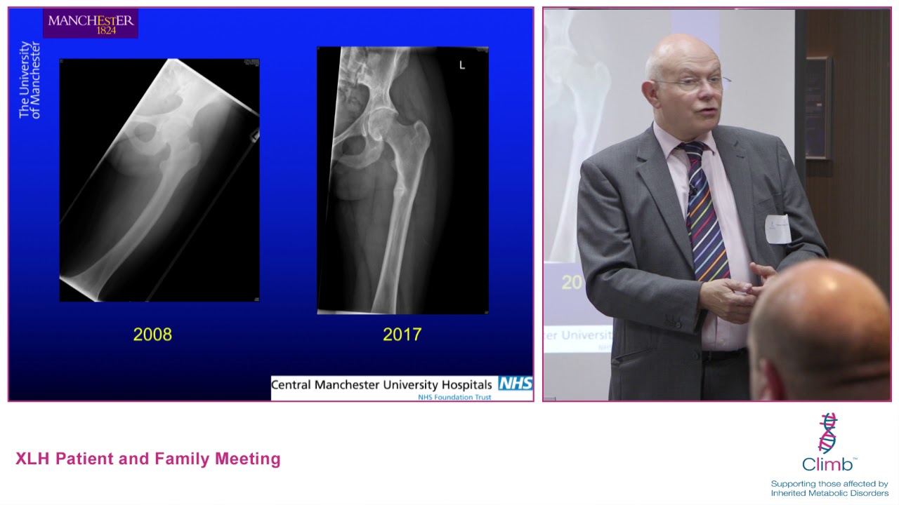 Climb XLH Patient and Family Day - Professor Peter Selby - YouTube