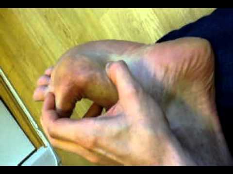 plantarfacit.avi