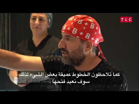 TLC / Doctor B / Rhinoplasty