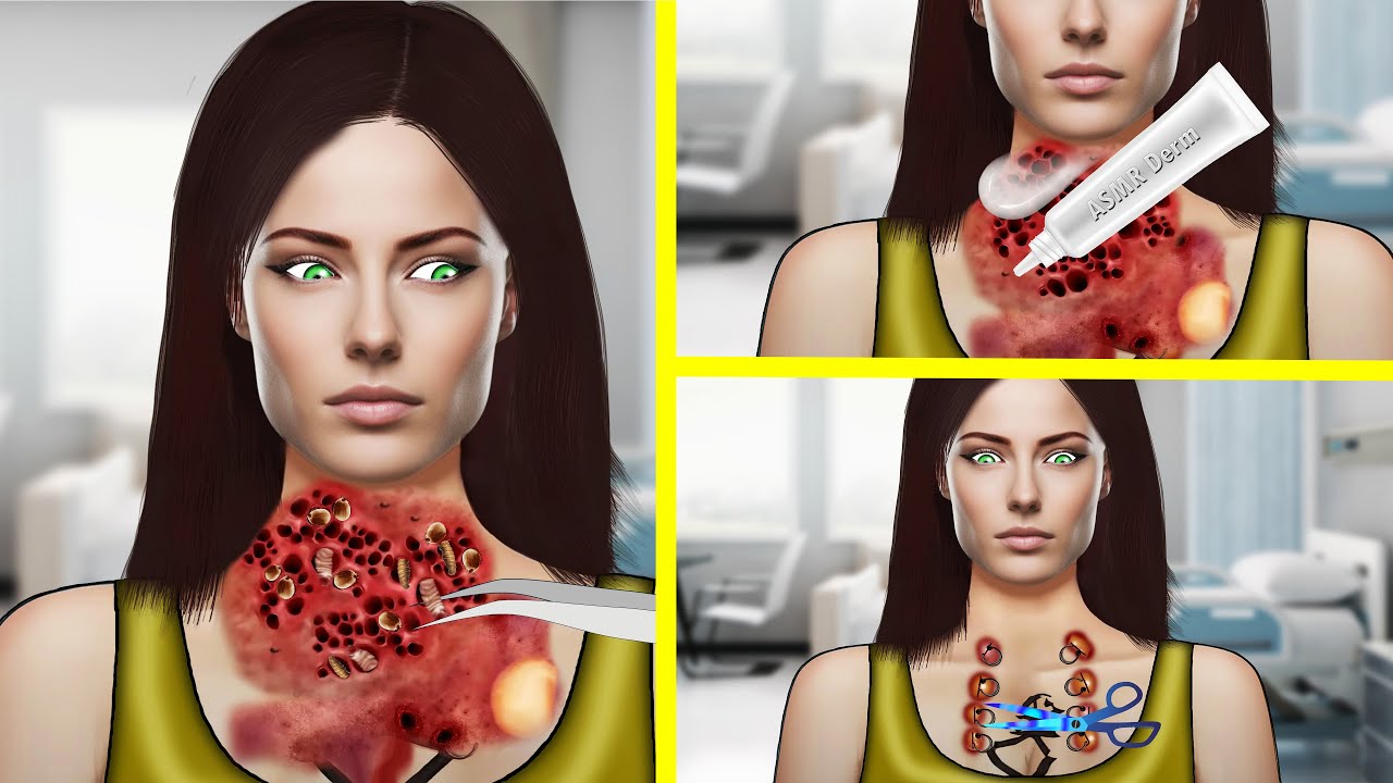 ASMR Chest body modification Animation | Corset Piercing Treatment ...