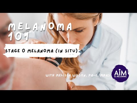 What Is The Treatment For Melanoma In Situ