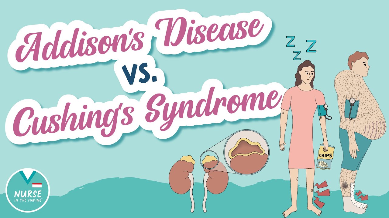 Addisons Disease