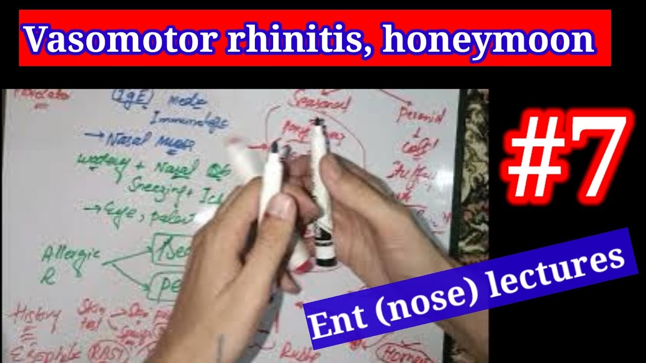 vasomotor rhinitis Honeymoon rhinitis 🔴 ENT (NOSE) LECTURES #7. # ...