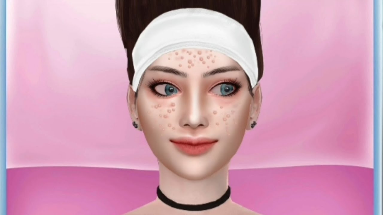 ASMR 粉刺黑头粉刺去除和白头提取/粉刺 Pimple blackhead Acne Removal & Whitehead ...