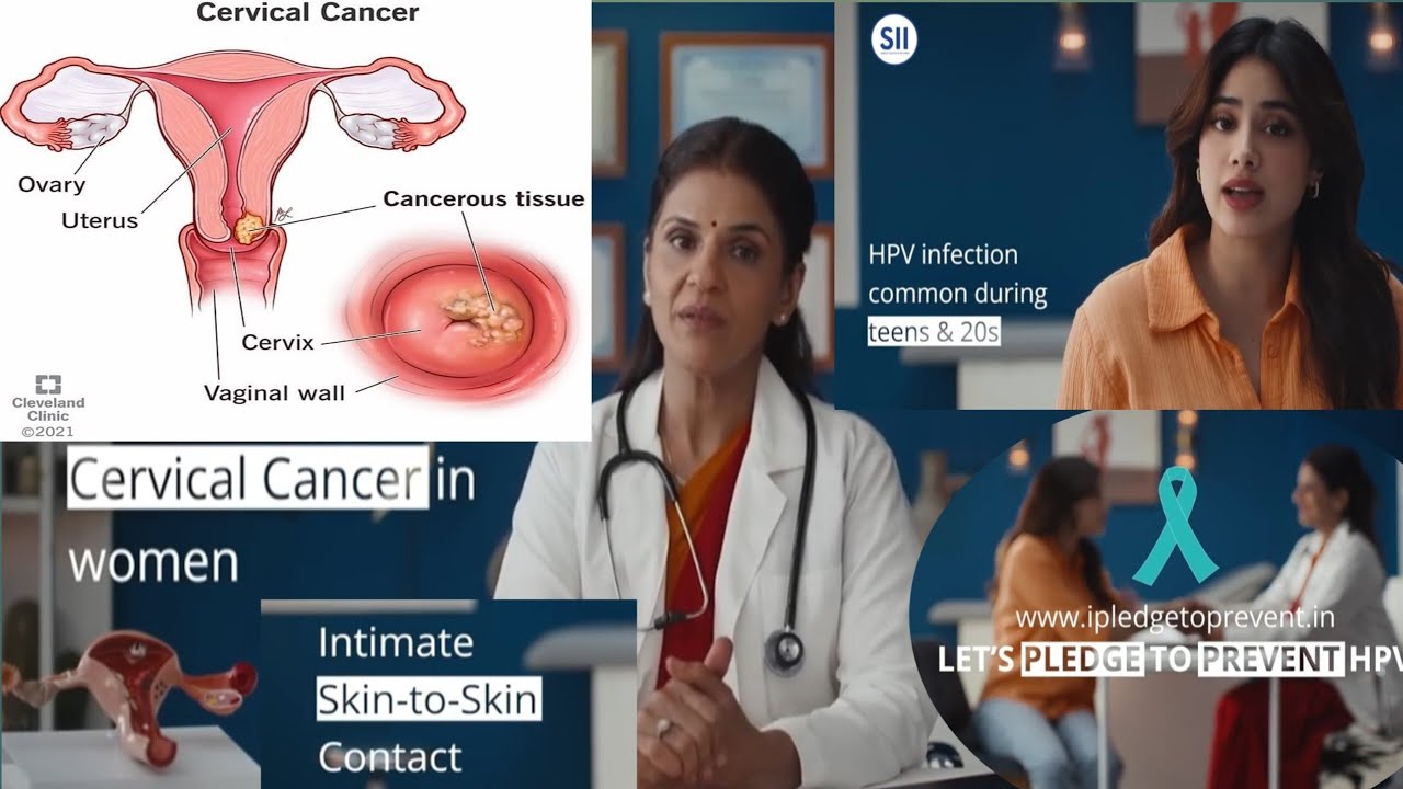 Virus | Cervical Cancer | संभोग से होने वाला कैंसर | HPV | Intimate ...