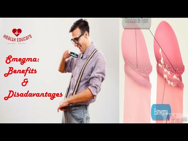 Accumulation De Smegma, Infection Shocked Doctor Discovers 30 YEAR