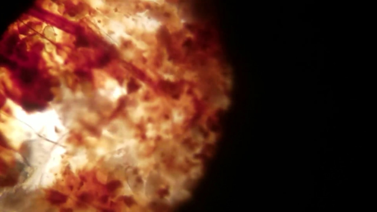 Microscope View of Ear Mites - YouTube