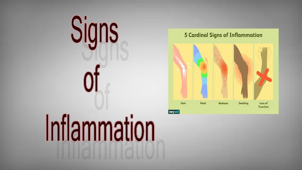 Signs of Inflammation.Dr. Sagar - YouTube