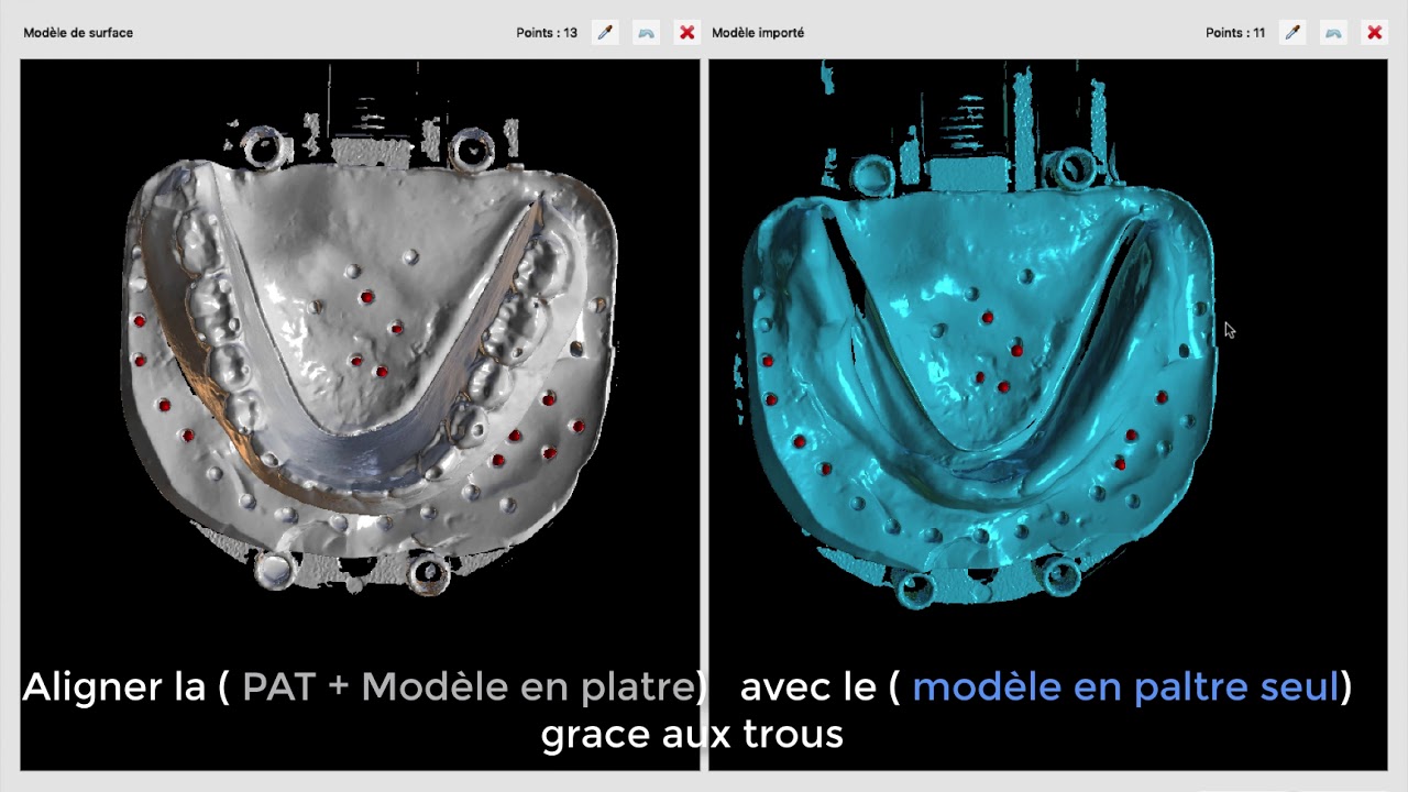 Technique Triple scan - YouTube