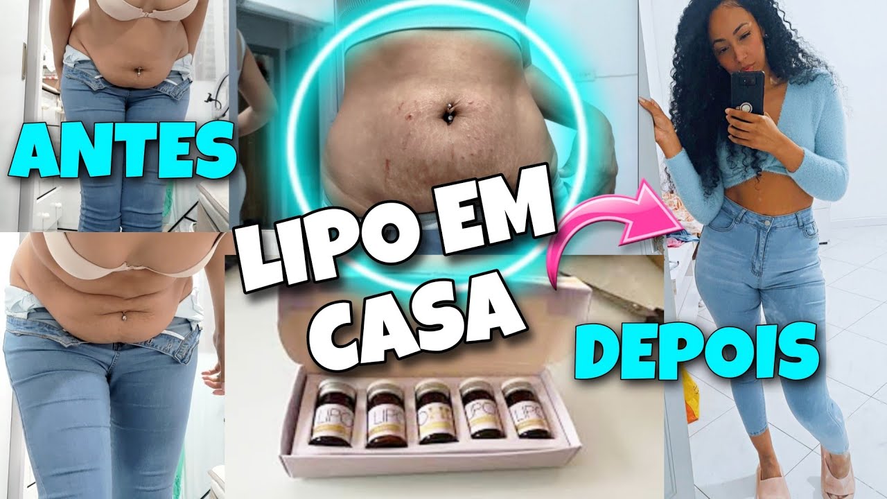 ANTES E DEPOIS DEPOIS DA LIPO HD EM CASA - COMO EU EMAGRECI RAPIDO ...