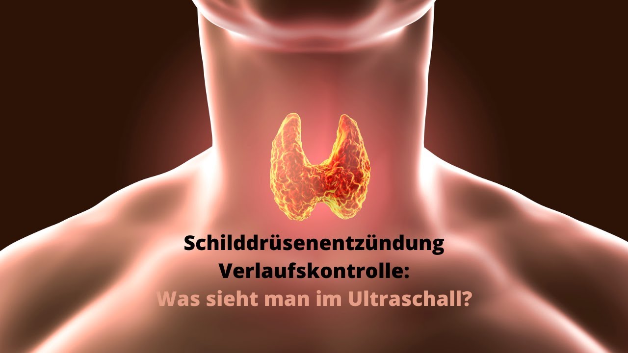 Verwunderlich Engegefuhl Im Hals Schilddruse Bilder