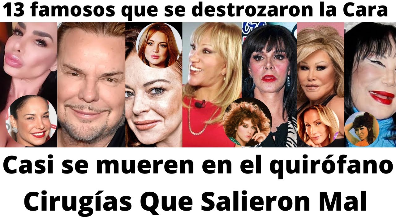 Las cirugías plásticas de los famosos que salieron mal - YouTube