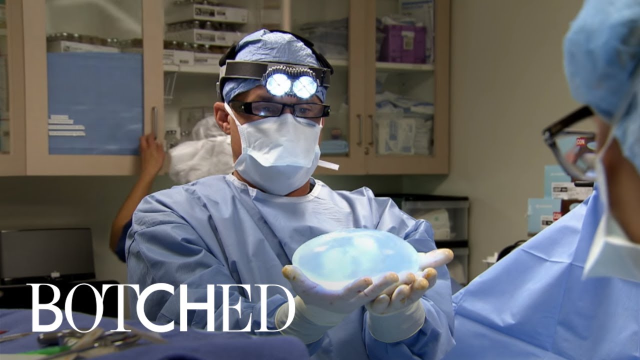 Botched Tv Show Uncensored 60 Photos - Moonagedaydream.film