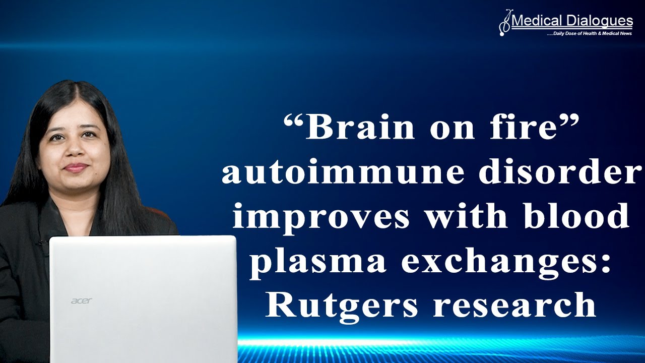 “Brain on fire” autoimmune disorder improves with blood plasma ...