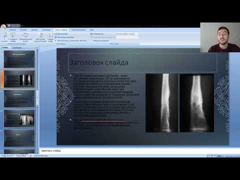 ДИФФЕРЕНЦИАЛЬНАЯ РЕНТГЕНОДИАГНОСТИКА ПЕРВИЧНЫХ ЗЛОКАЧЕСТВЕННЫХ ОПУХОЛЕЙ КОСТЕЙ
