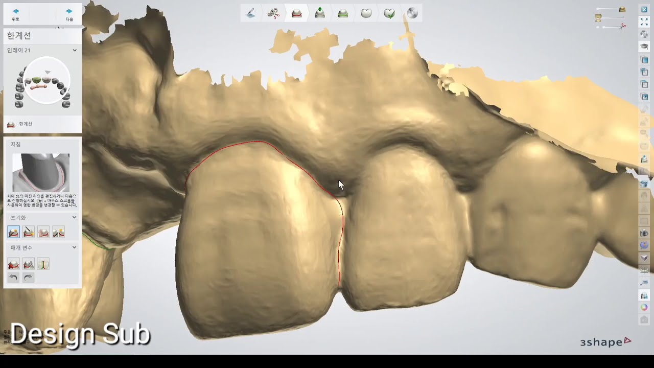 3shape design - YouTube