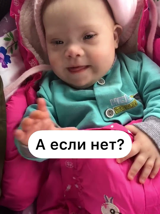 Синдром Дауна жизнь с особенным ребёнком Youtube