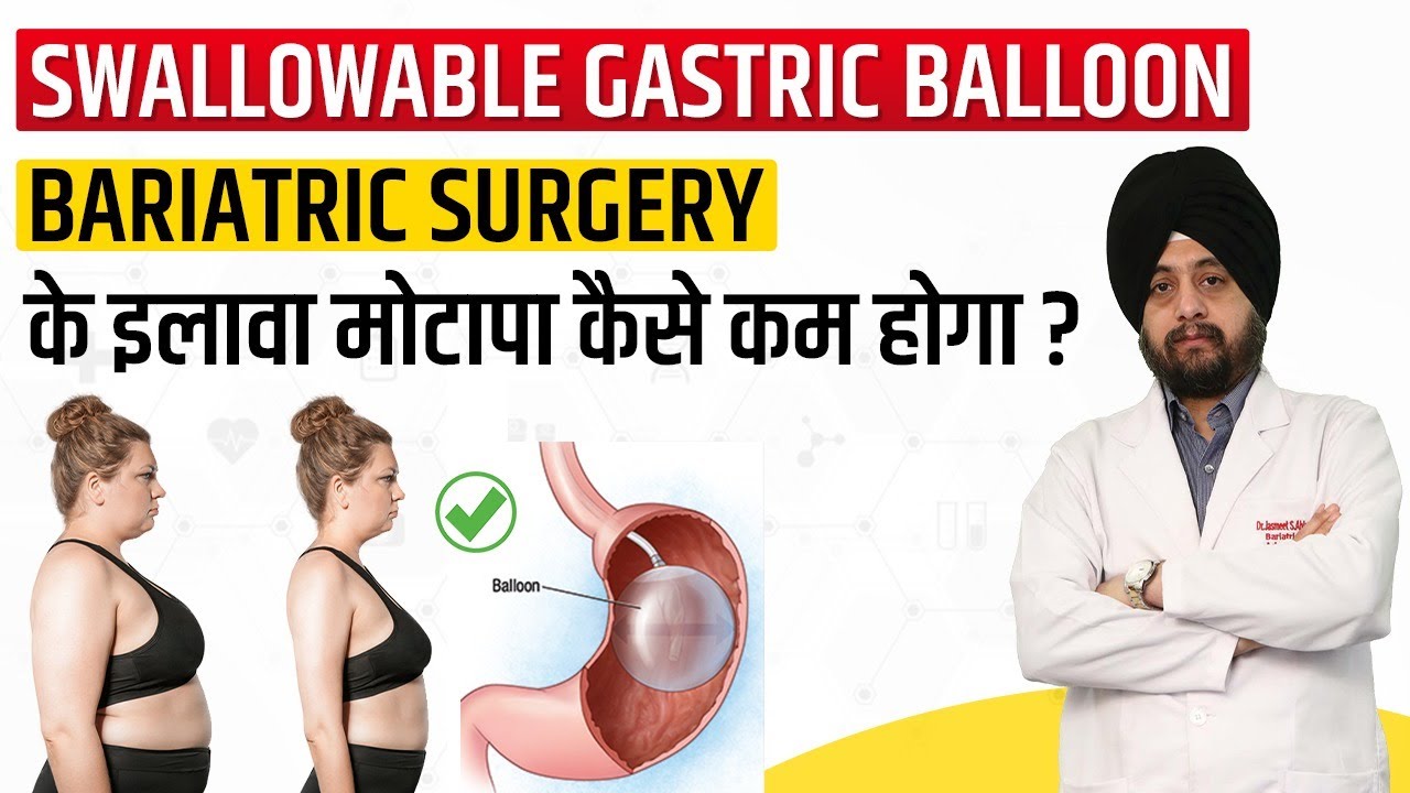 Swallowable Gastric Balloon | Allurion Pill | How to Reduce Weight ...