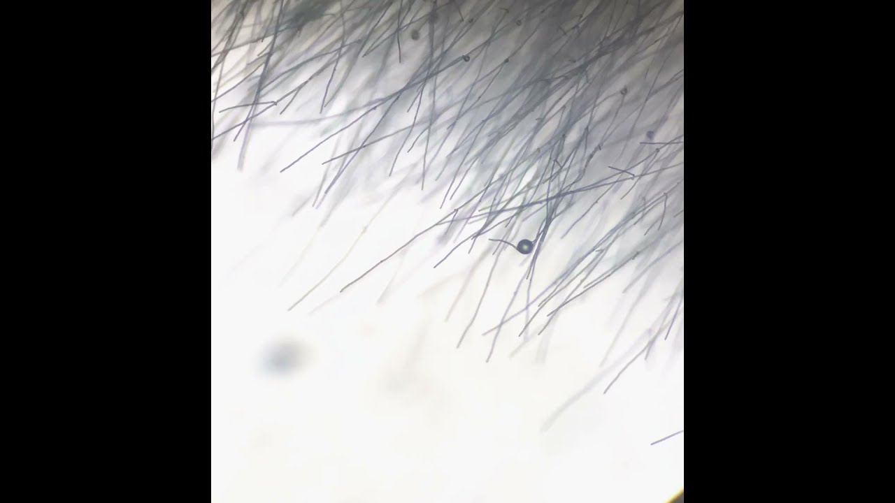 Timelapse of Mycelium Under Microscope - YouTube