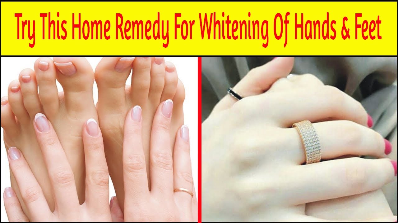 Try This Remedy for Whitening of Hands & Feet||How to white hands and ...