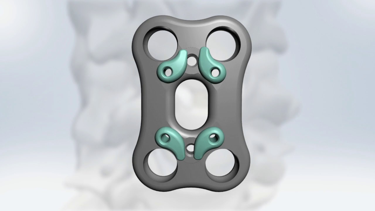 Precision Spine® Slimplicity® Anterior Cervical Plate System - YouTube