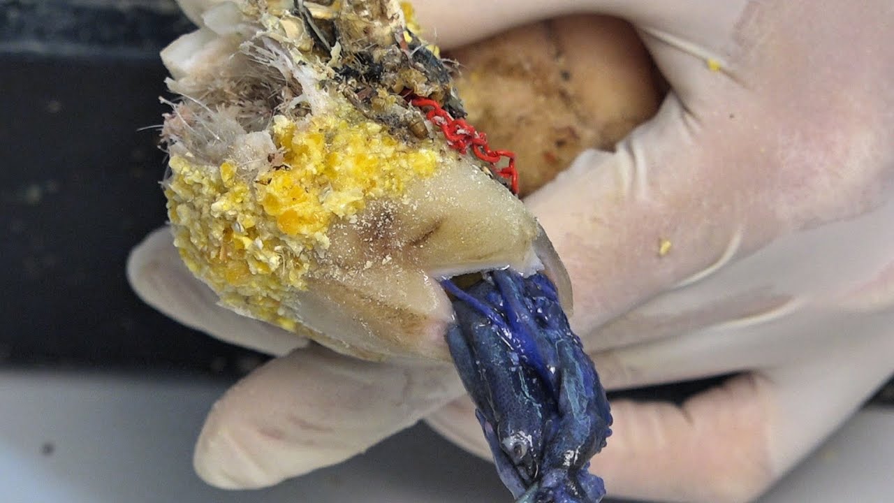 CUT Ingrown Toenails 👣 Toenails with Maggots, Fungal Toenails ...