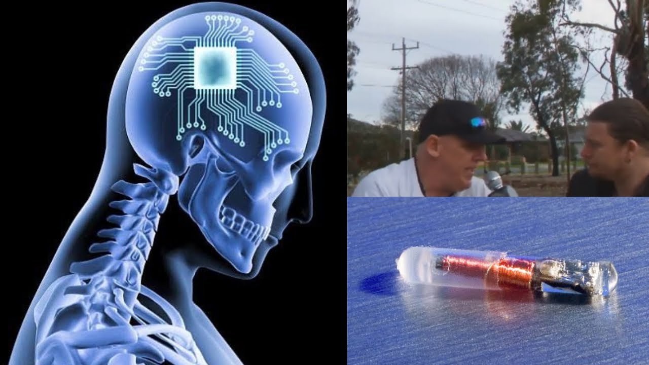 We Are Change Talk Show: RFID MICROCHIP IMPLANTS REAL TESTIMONY - YouTube