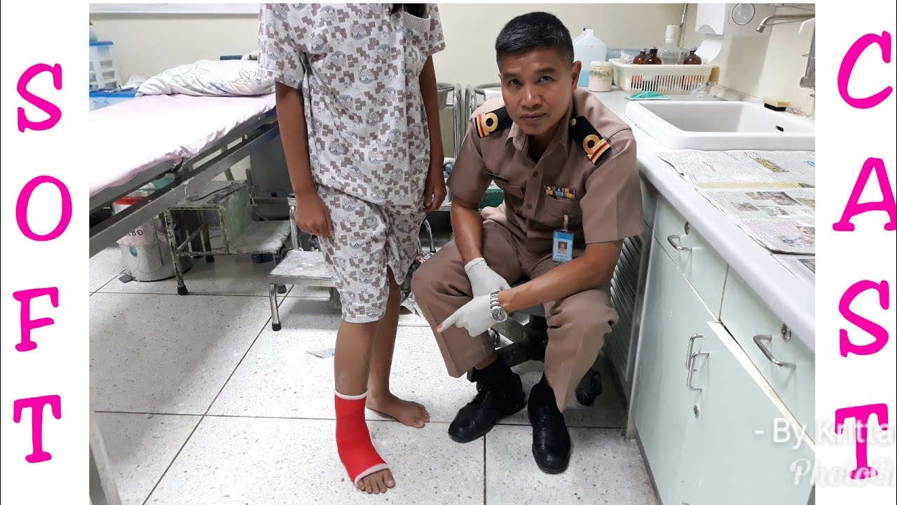 Soft cast for ankle sprain by "RAKE"KRITTANAI - YouTube