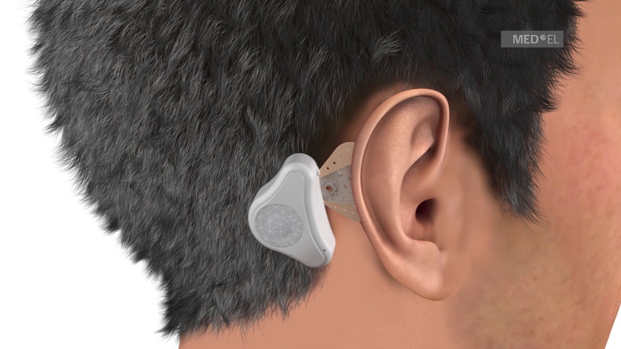 Como funciona o ADHEAR - YouTube