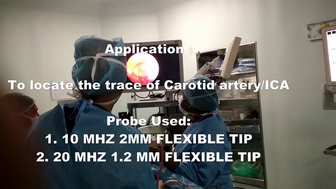 Micro Doppler for localizing the Carotid Artery in Endoscopic Skullbase ...