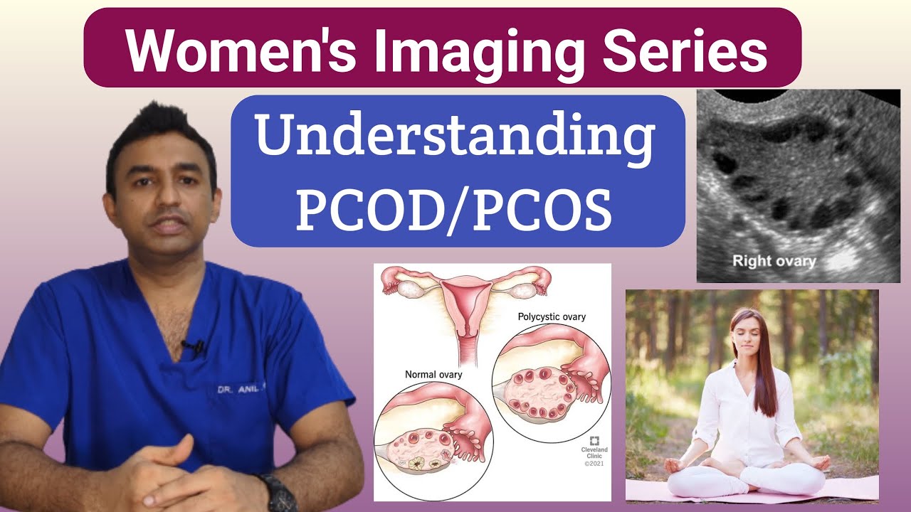 "Understanding PCOD/PCOS : Causes, Symptoms, complications and ...