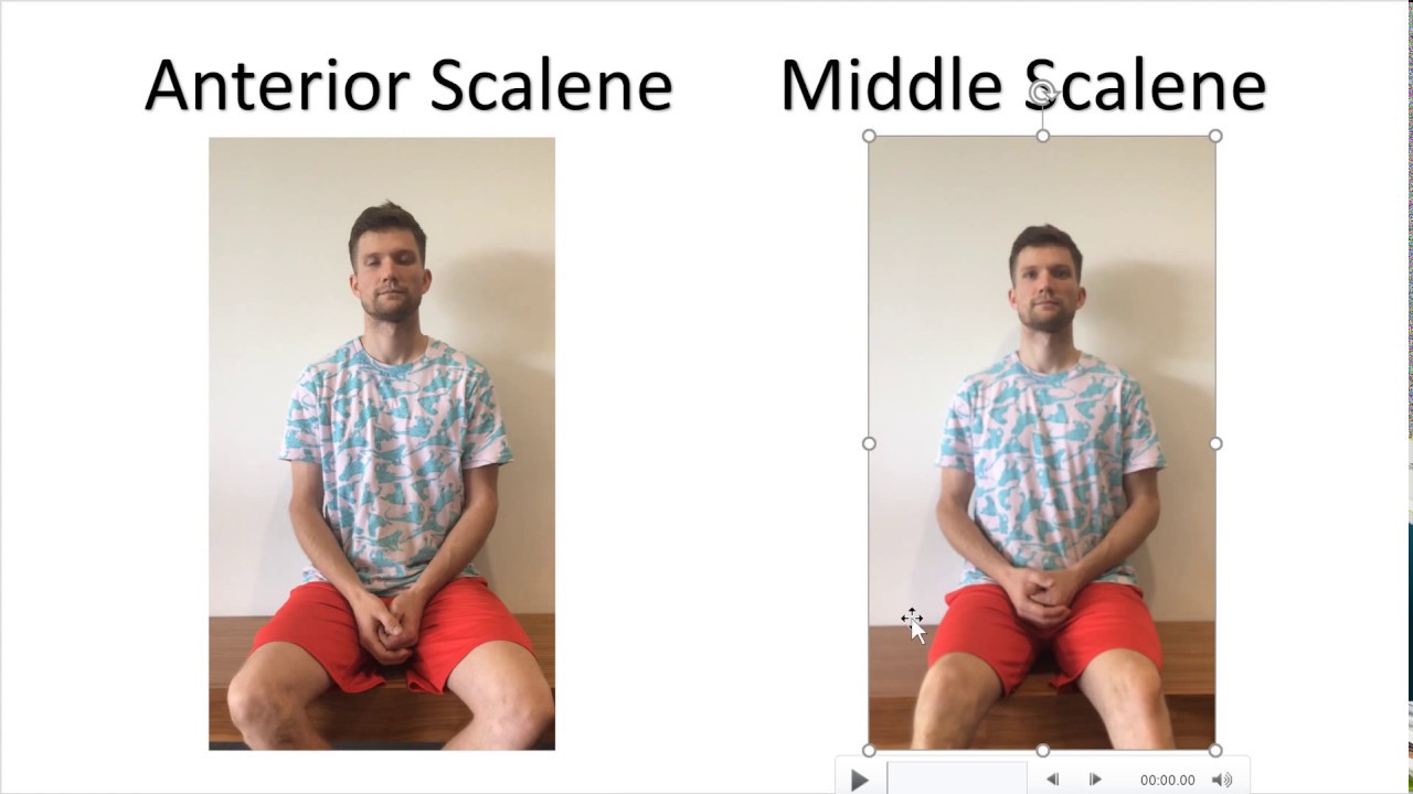 Thoracic Outlet Syndrome; 2 simple exercises - YouTube