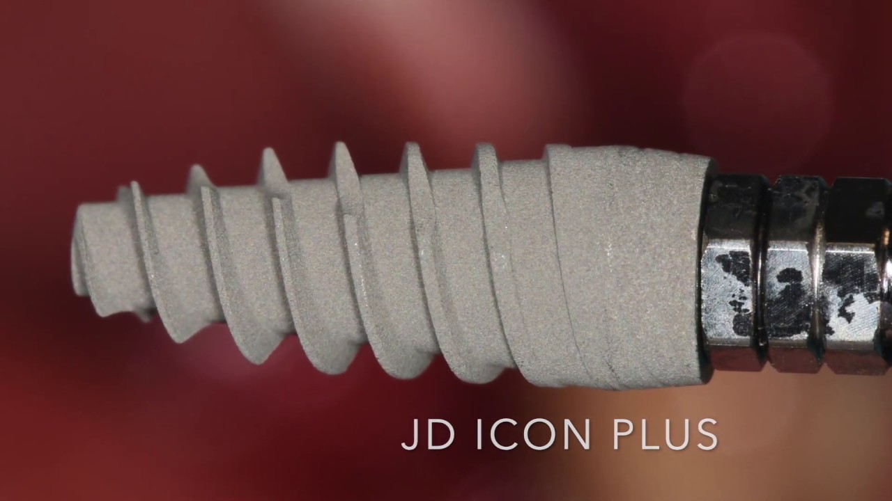 AnyRidge surgical kit for JD Icon plus placement. By Dr. Bechara - YouTube