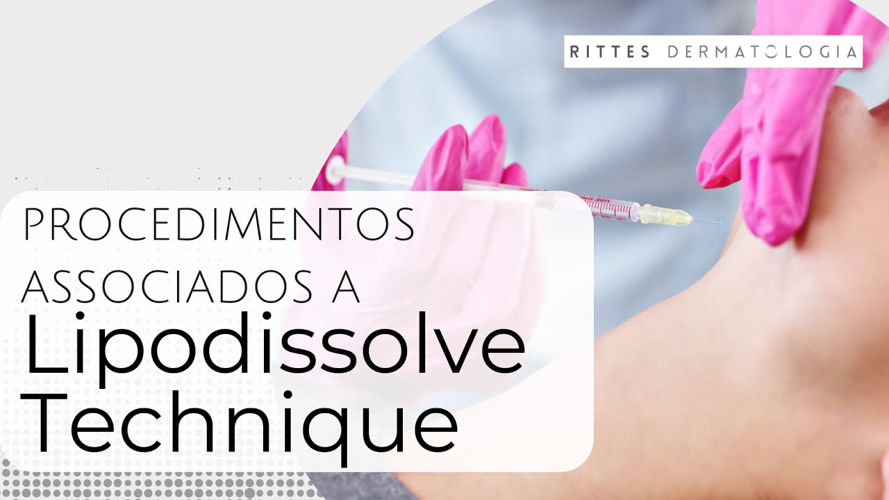 Top 3: procedimentos para associar a Lipodissolve Technique - YouTube