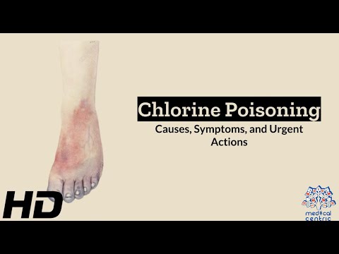Chlorine Poisoning: Signs and Life-Saving Measures