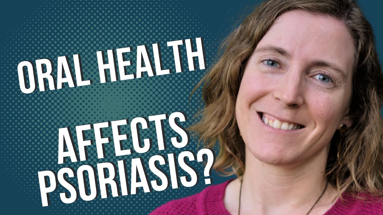 Unlocking the Link: How Oral Health Affects Psoriasis - YouTube