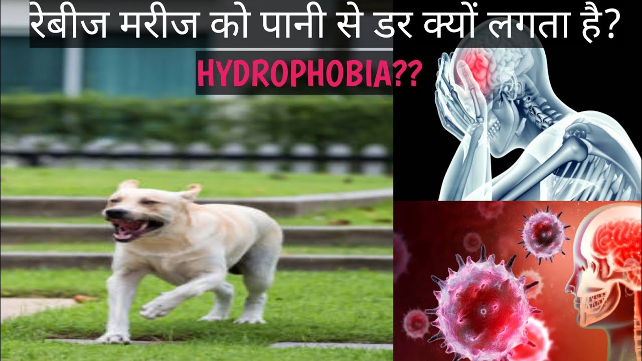 Hydrophobia Rabies